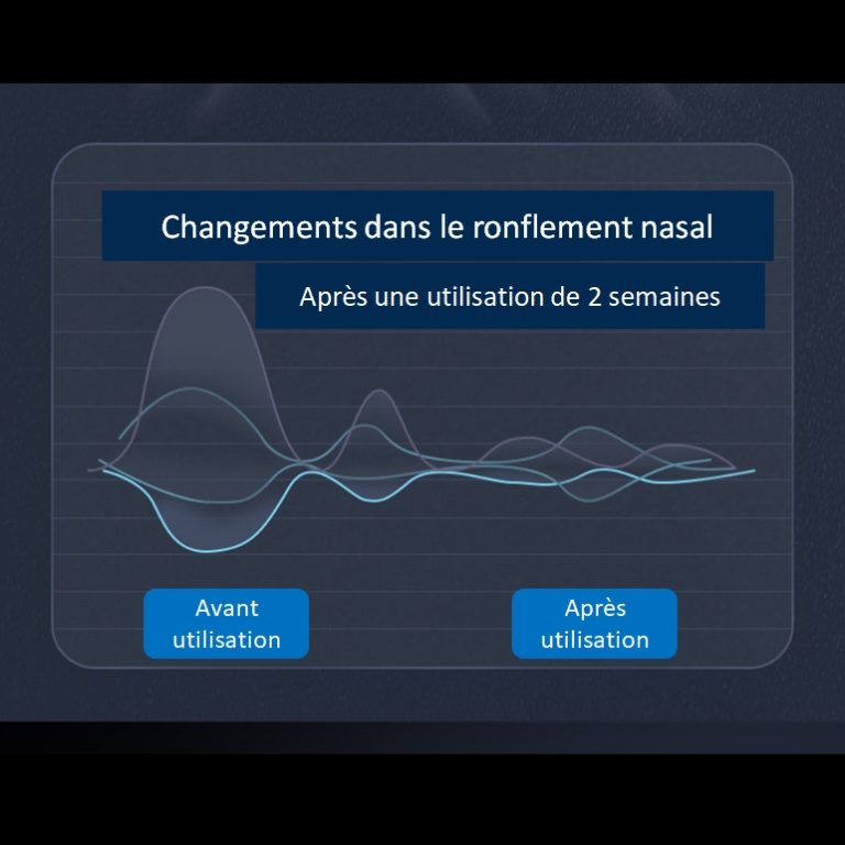 Anti ronflement efficace | Moderne et design
